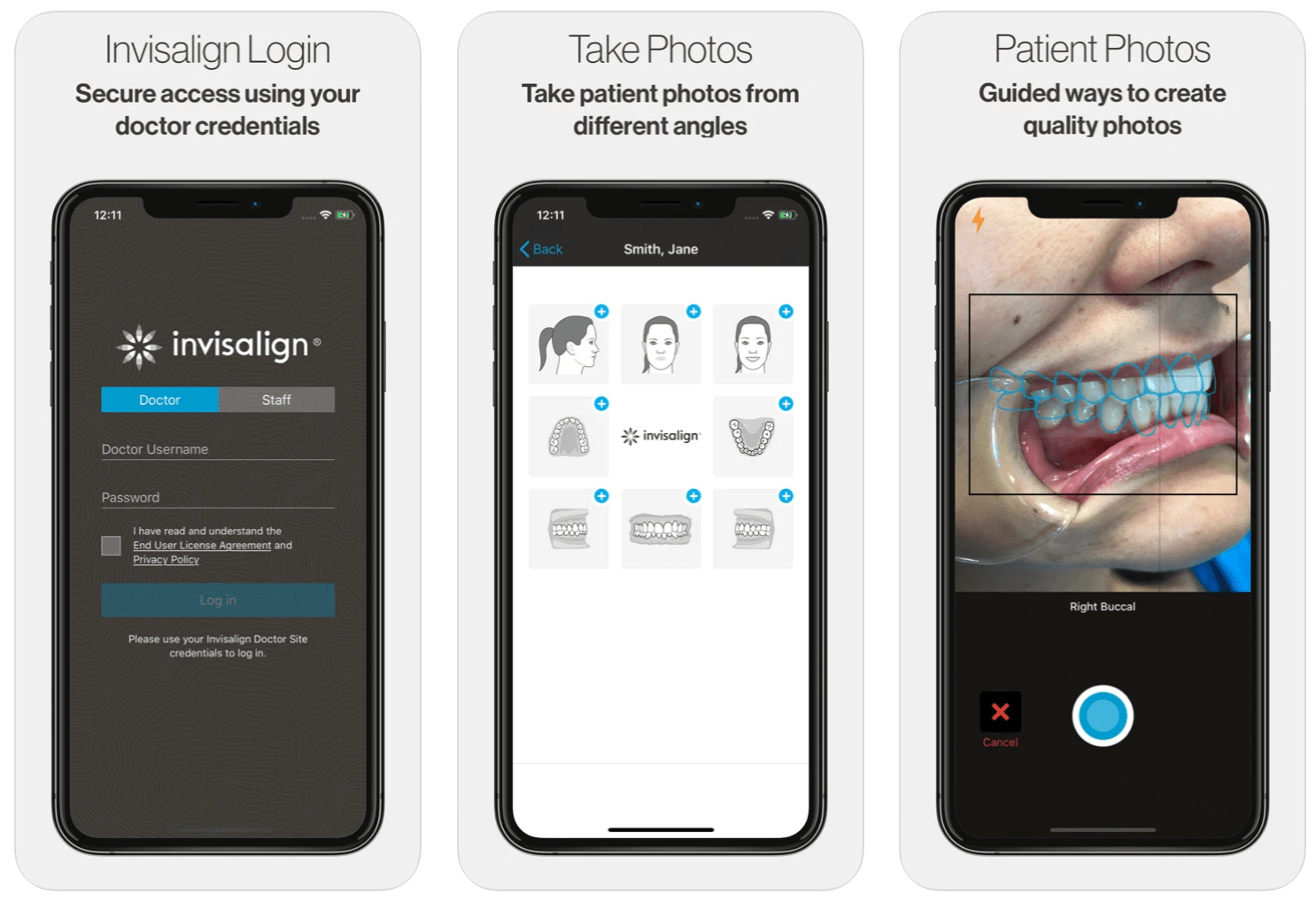 Le App Per Invisalign, Come Gestire Gli Aligner Trasparenti