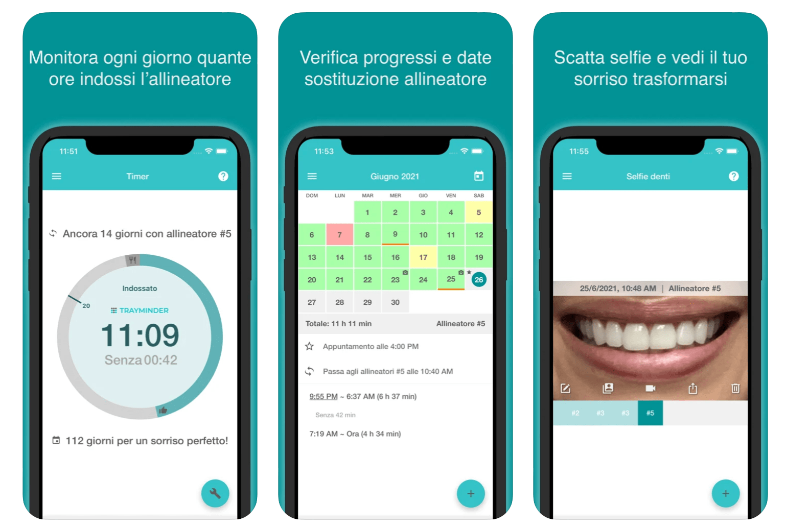 Le App Per Invisalign, Come Gestire Gli Aligner Trasparenti
